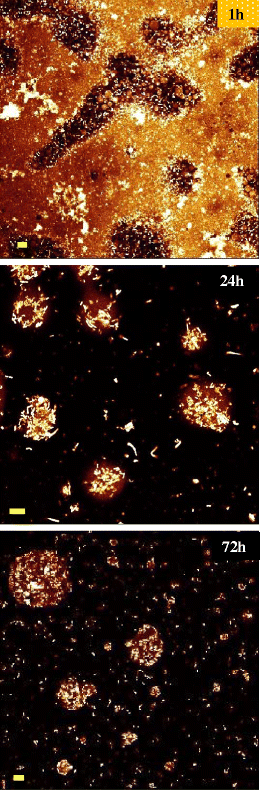Complex Coacervation as a Novel Microencapsulation Technique to Improve ...