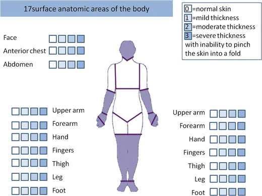Cutaneous Manifestations of Scleroderma and Scleroderma-Like Disorders ...