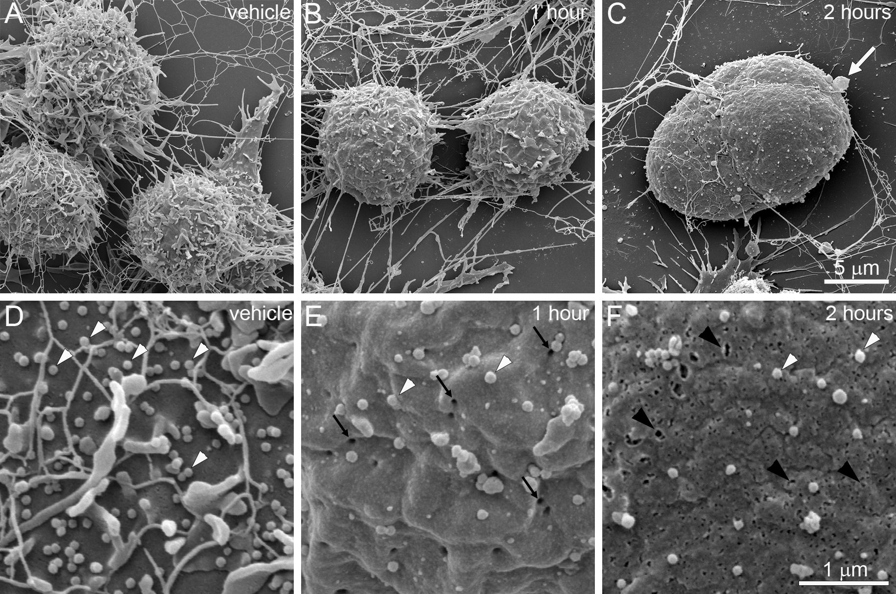 Ultrastructural Characteristics of DHA-Induced Pyroptosis | SpringerLink