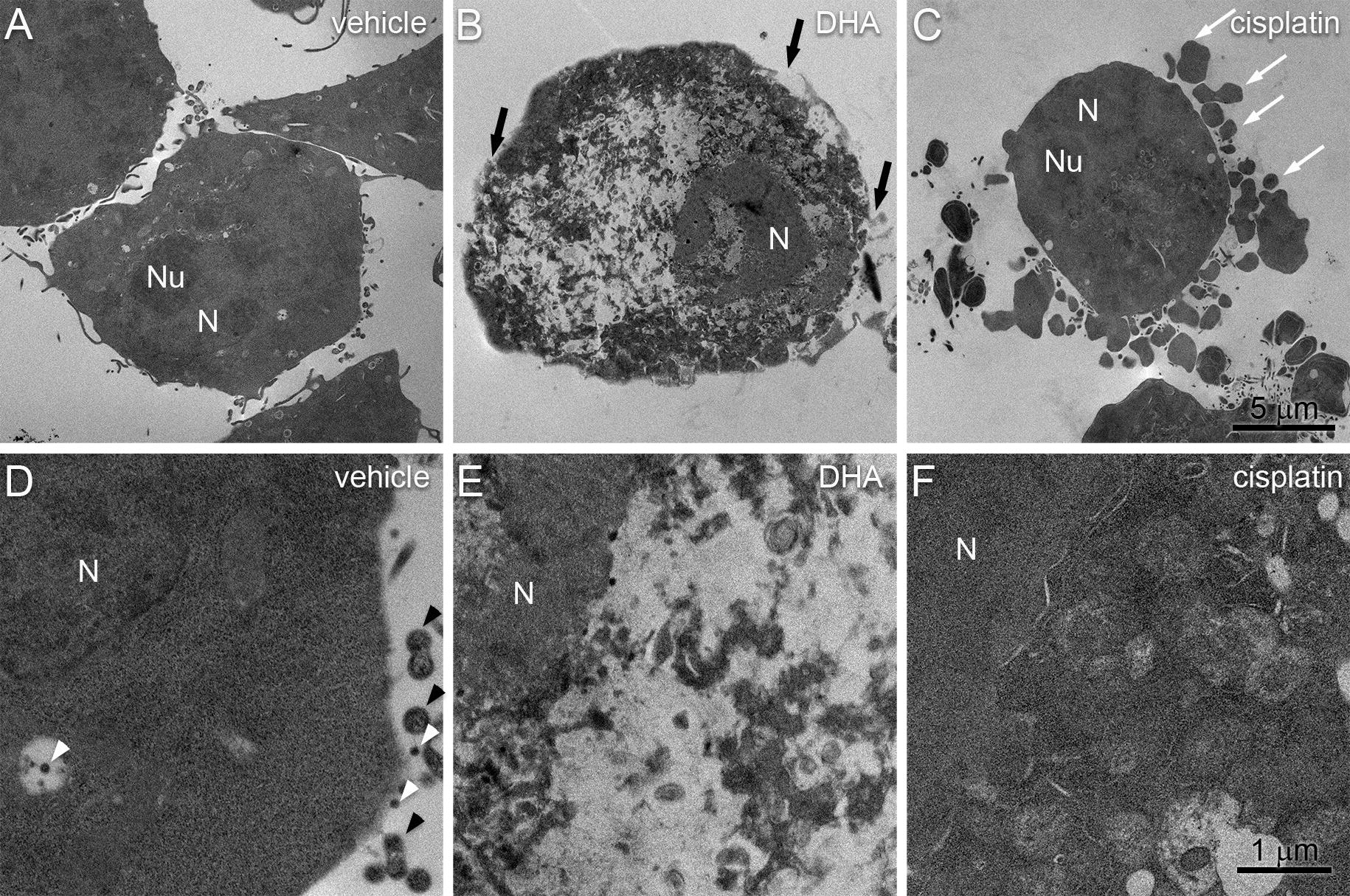 Ultrastructural Characteristics of DHA-Induced Pyroptosis | SpringerLink