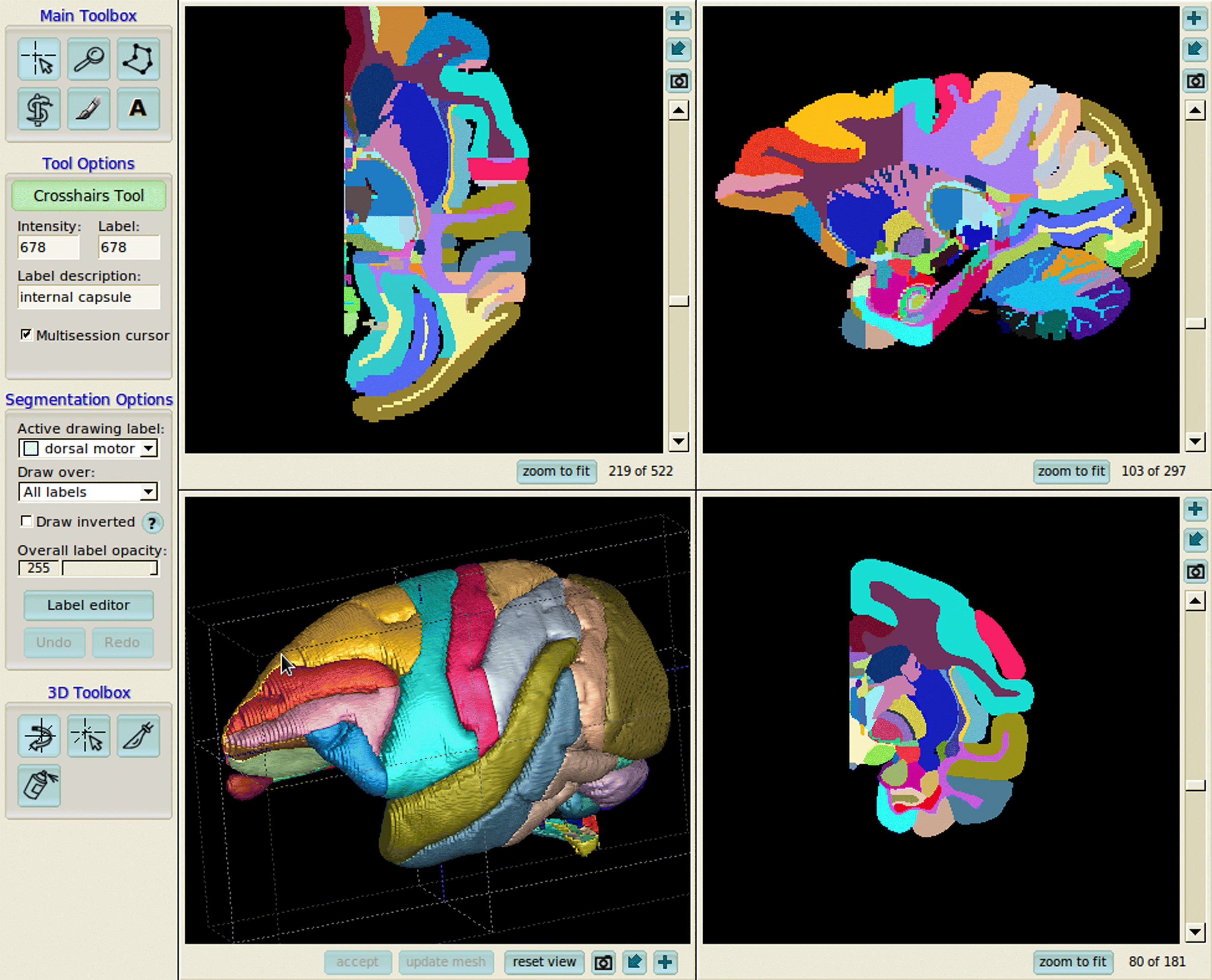 3D Brain Atlas Reconstructor Service—Online Repository of Three ...