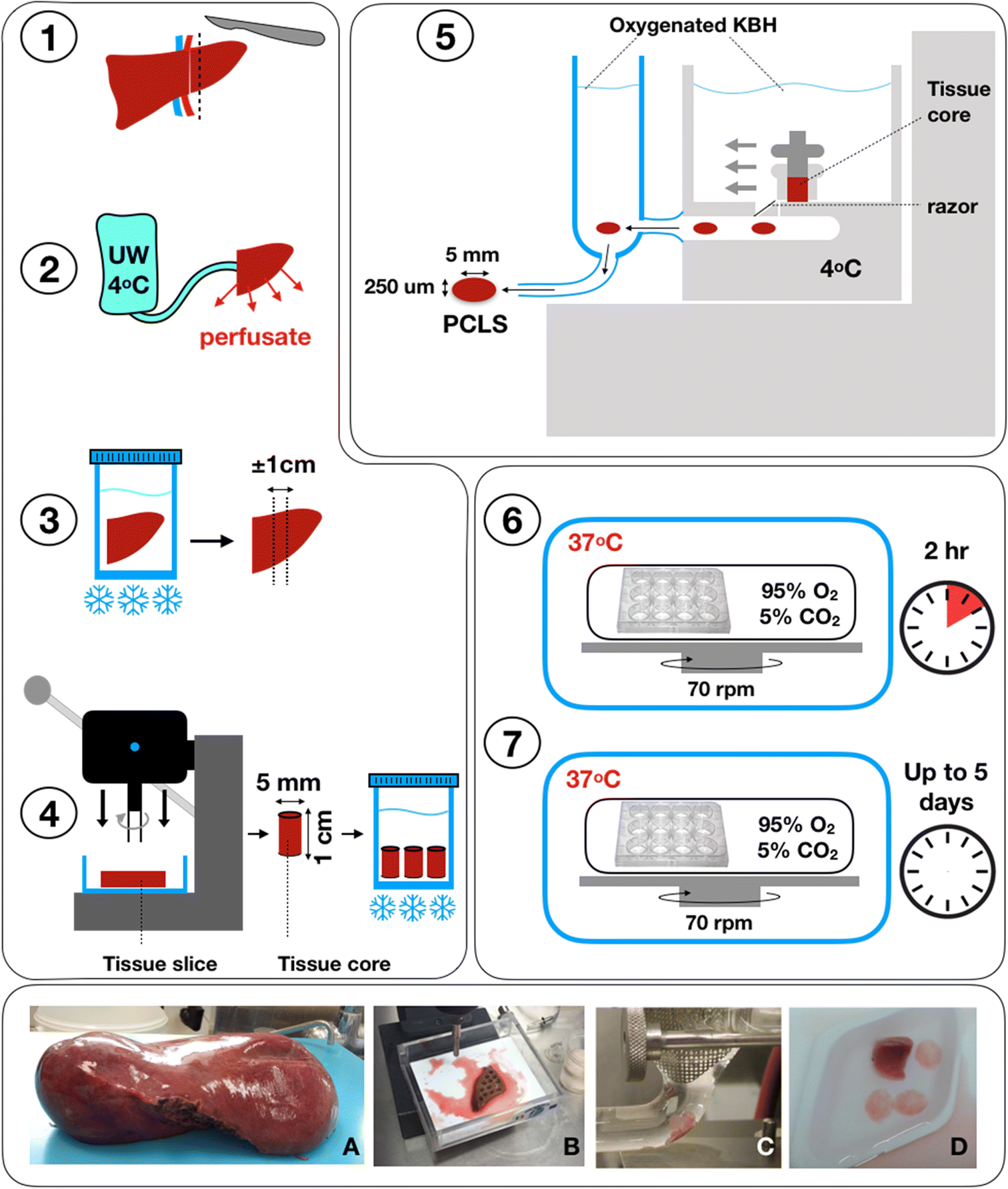 Precision-cut liver slices: a versatile tool to advance liver research ...