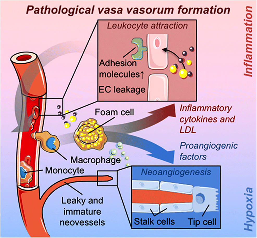 Vasa vasorum inside out/outside in communication: a potential role in ...