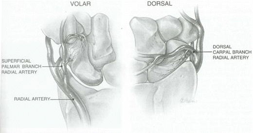 Assessment of scaphoid fracture healing | SpringerLink
