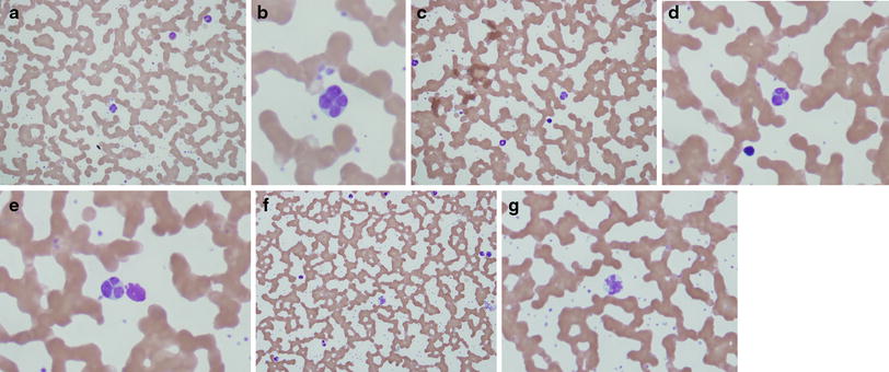 All that glitters is not gold: differential diagnosis of clover-leaf ...