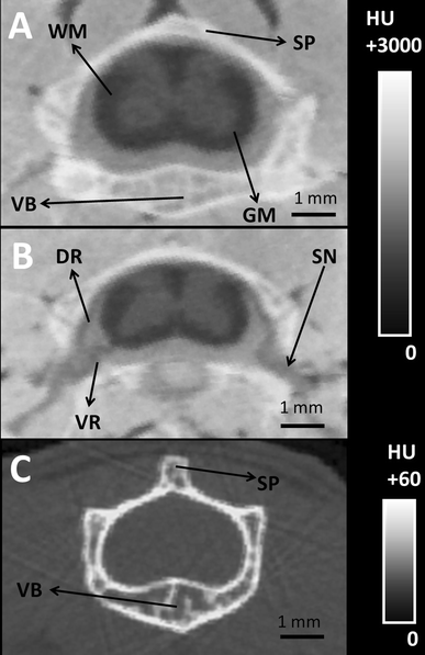Visualization of mouse spinal cord microscopic structures by use of ex ...
