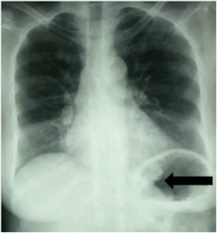 Diagnosing Gastric Cancer in Chest X-ray | SpringerLink