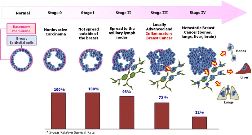 Inflammatory and microenvironmental factors involved in breast cancer ...