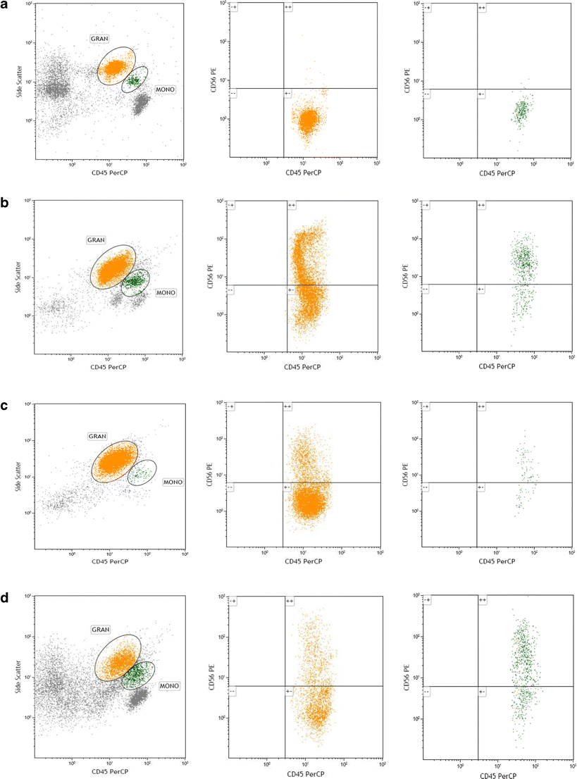 Aberrant expression of CD56 on granulocytes and monocytes in ...