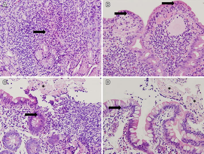 Case report of cheilitis granulomatosa and joint complaints as ...