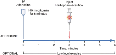 ASNC imaging guidelines for SPECT nuclear cardiology procedures: Stress ...