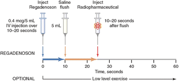 ASNC imaging guidelines for SPECT nuclear cardiology procedures: Stress ...