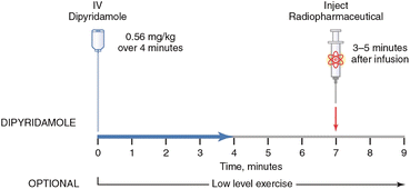 ASNC imaging guidelines for SPECT nuclear cardiology procedures: Stress ...