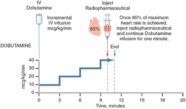 ASNC imaging guidelines for SPECT nuclear cardiology procedures: Stress ...