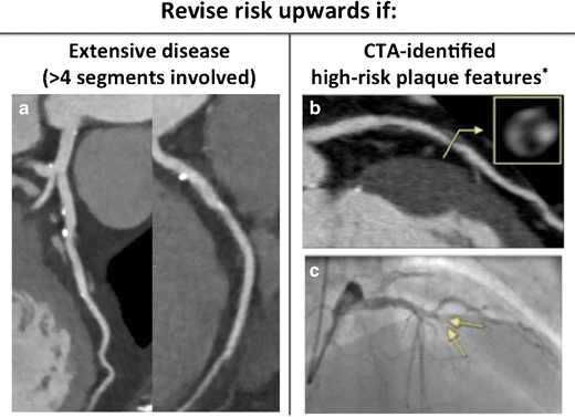 Management of Coronary Artery Calcium and Coronary CTA Findings ...