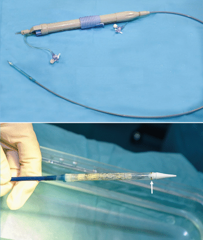 Early experience with the Venus p‑valve for percutaneous pulmonary ...