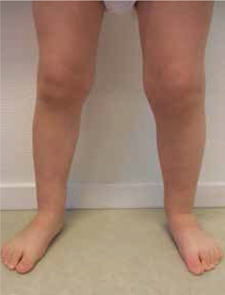 De anatomie en fysiologie van de kindervoet | SpringerLink