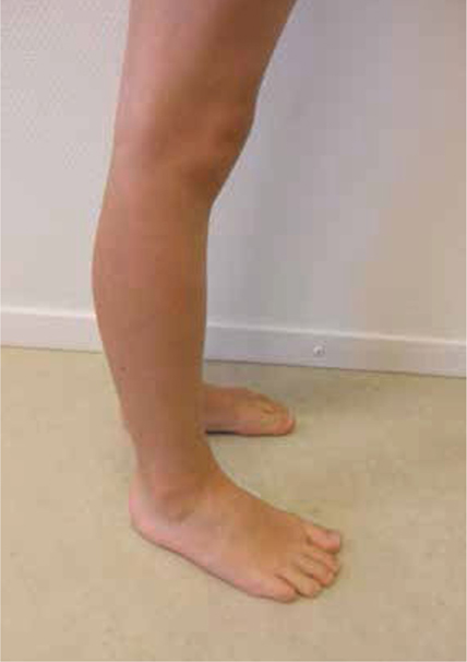 De anatomie en fysiologie van de kindervoet | SpringerLink