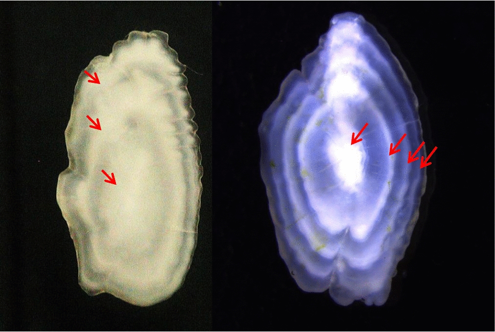 A description of four types of otolith opaque zone | SpringerLink