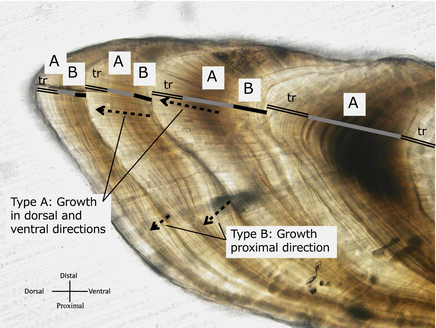 A description of four types of otolith opaque zone | SpringerLink
