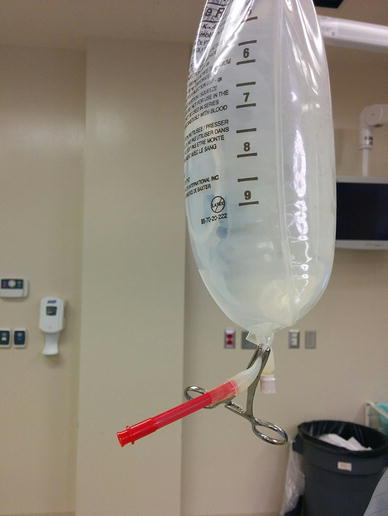 Preventing intravenous bag contamination | SpringerLink