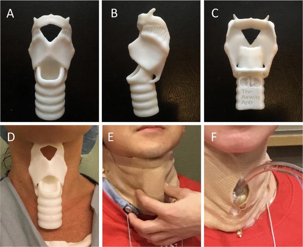 Front-of-neck airway meets front-of-neck simulation: improving ...