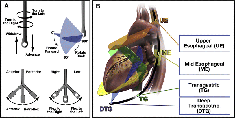 Perioperative transesophageal echocardiography for non-cardiac surgery ...
