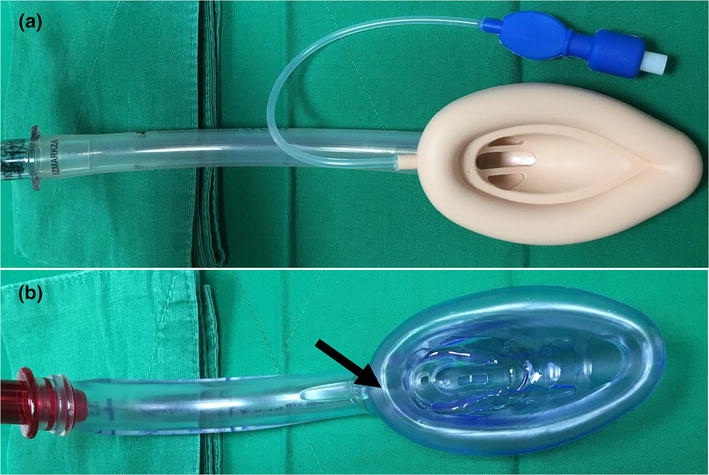 Self-pressurized air-Q® intubating laryngeal airway versus the LMA ...
