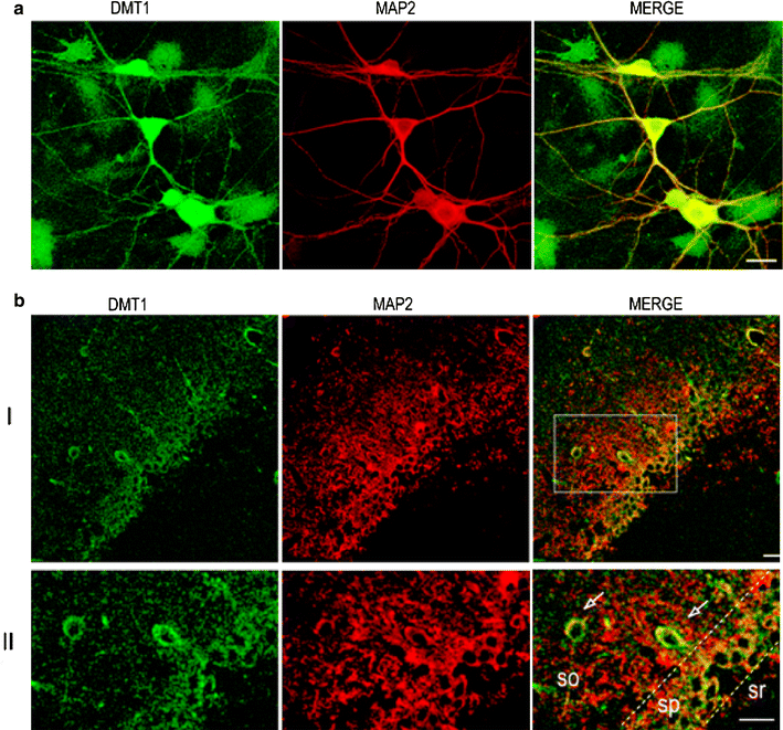 Increased Hippocampal Expression of the Divalent Metal Transporter 1 ...