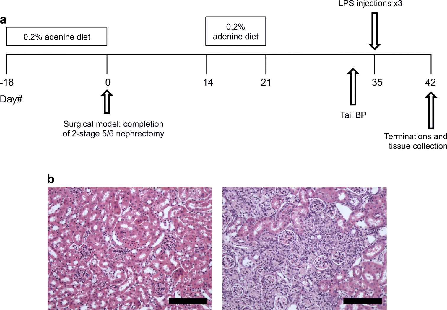 Chronic Kidney Disease Increases Cerebral Microbleeds in Mouse and Man ...