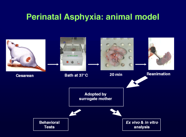 Birth asphyxia as the major complication in newborns: moving towards ...