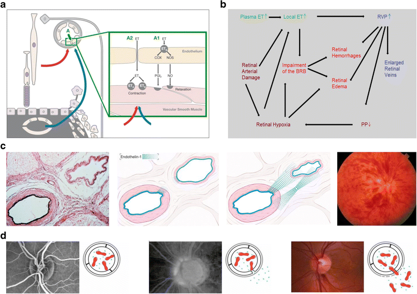 The discovery of the Flammer syndrome: a historical and personal ...