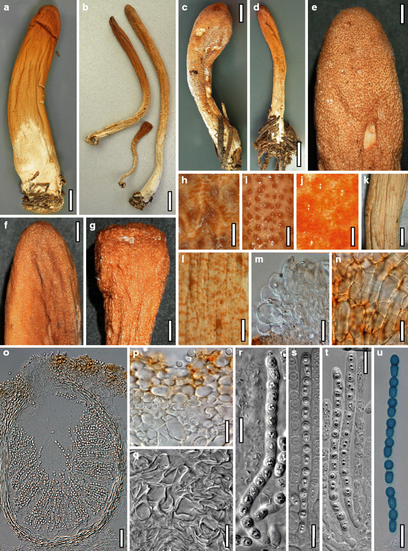 European species of Hypocrea part II: species with hyaline ascospores ...