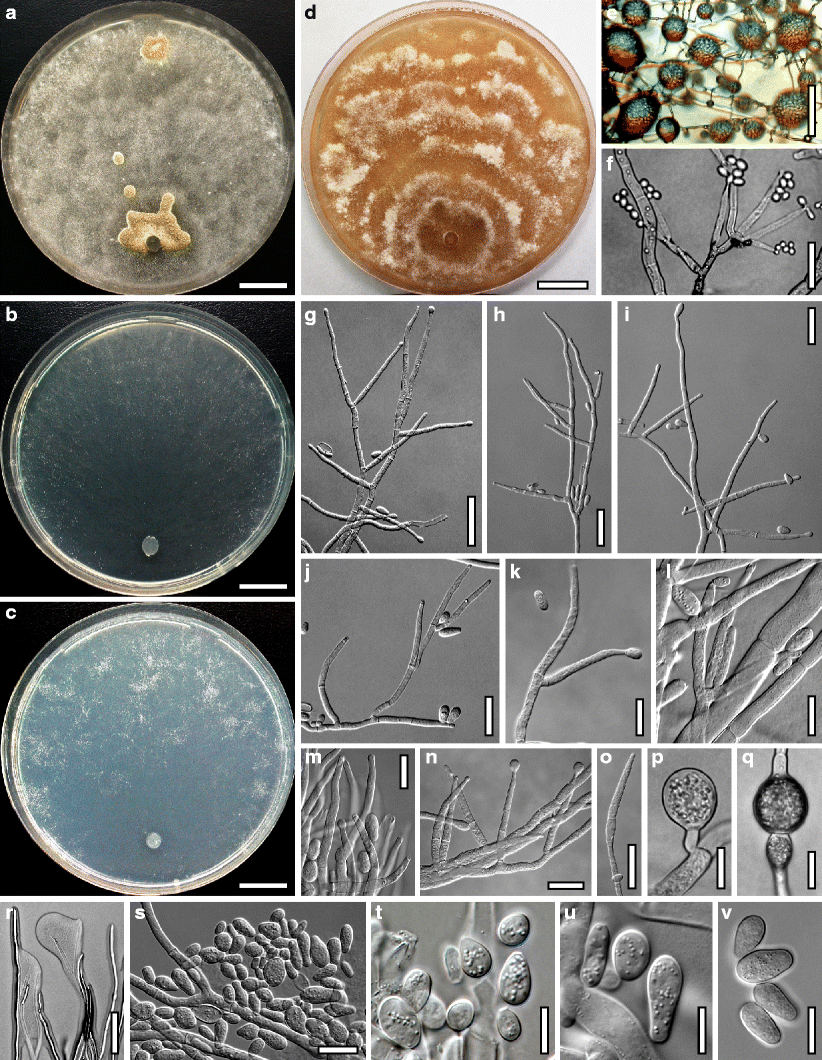 European species of Hypocrea part II: species with hyaline ascospores ...