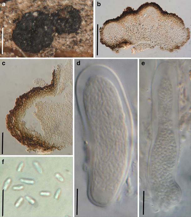 Pleosporales | SpringerLink