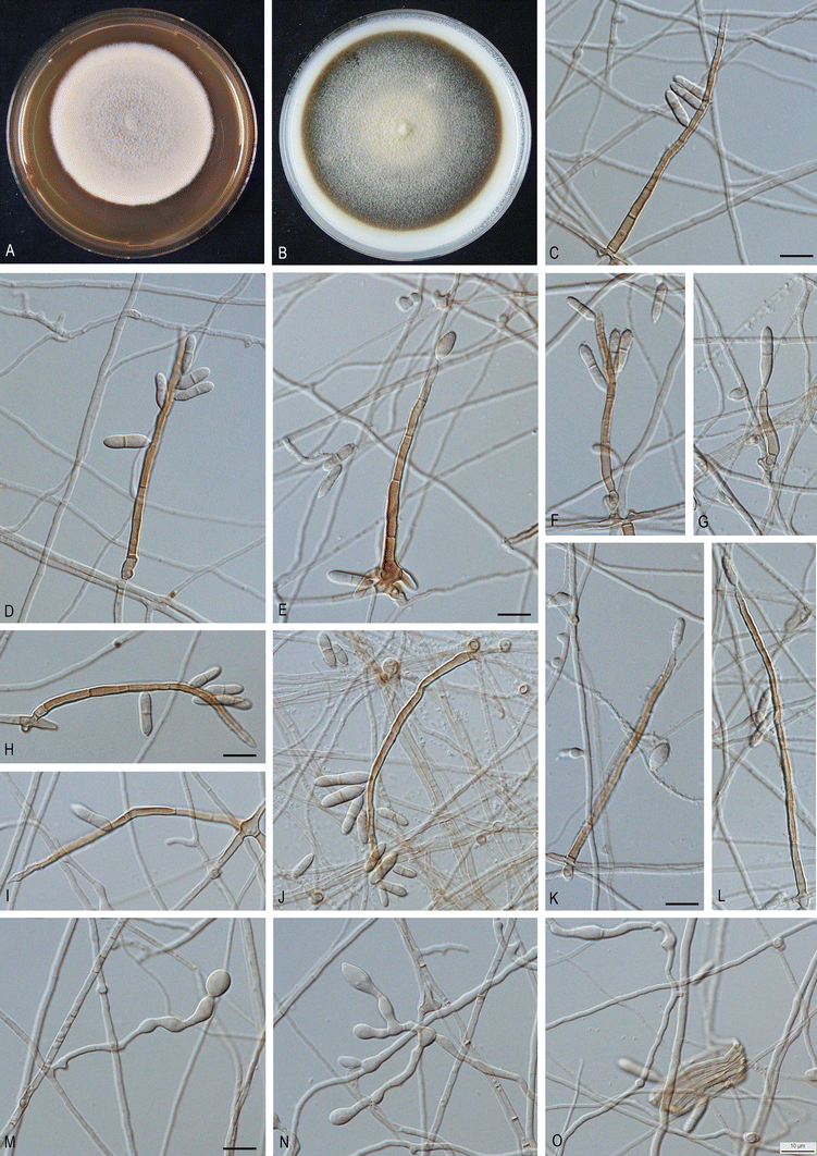 Taxonomy of Ochroconis, genus including opportunistic pathogens on ...