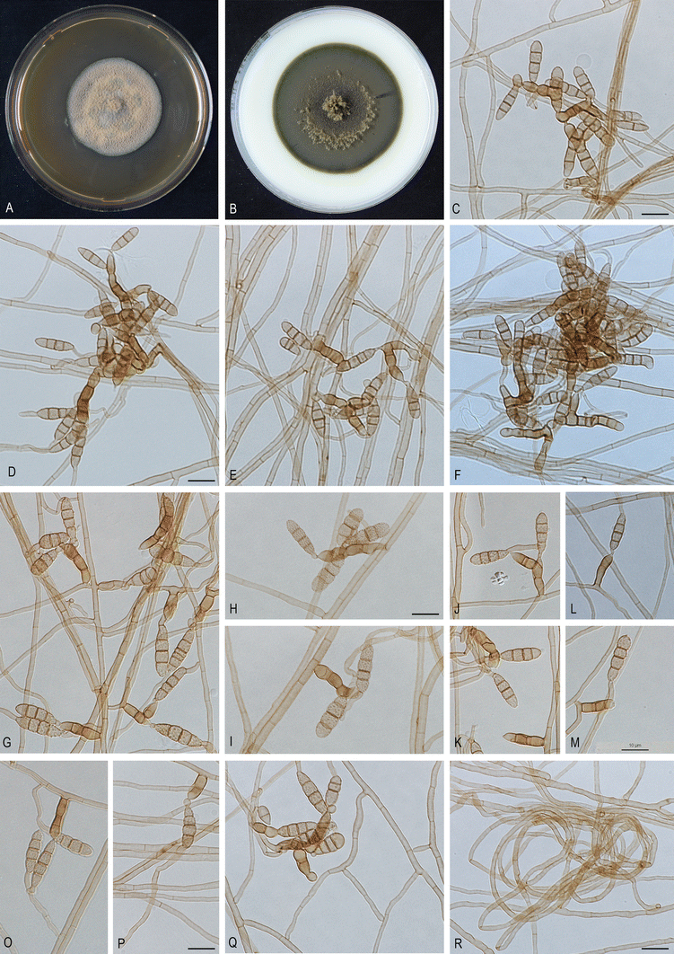 Taxonomy of Ochroconis, genus including opportunistic pathogens on ...
