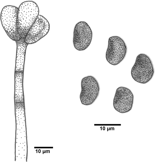 Overview of Stachybotrys ( Memnoniella) and current species status ...