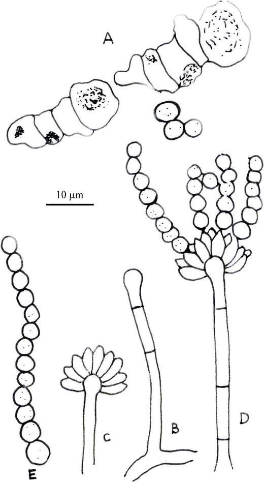 Overview of Stachybotrys ( Memnoniella) and current species status ...