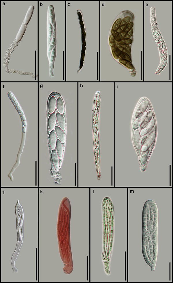 DISCOMYCETES: the apothecial representatives of the phylum Ascomycota ...