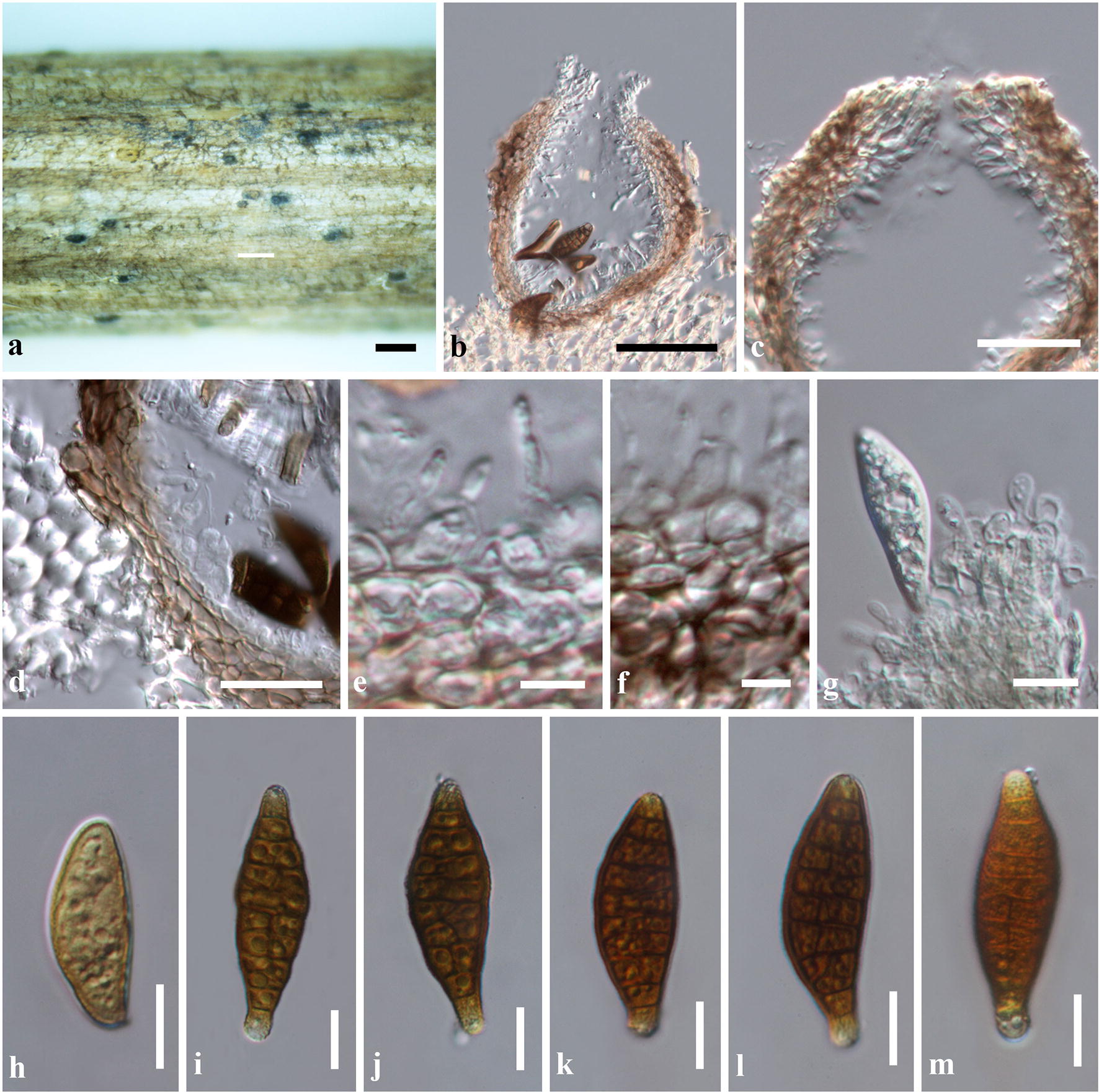 Fungal diversity notes 929–1035: taxonomic and phylogenetic ...