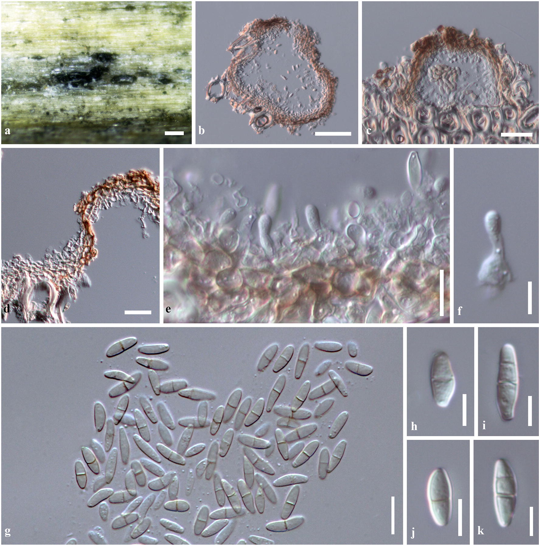 Fungal diversity notes 929–1035: taxonomic and phylogenetic ...