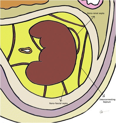 Radiological diagnosis of perinephric pathology: pictorial essay 2015 ...
