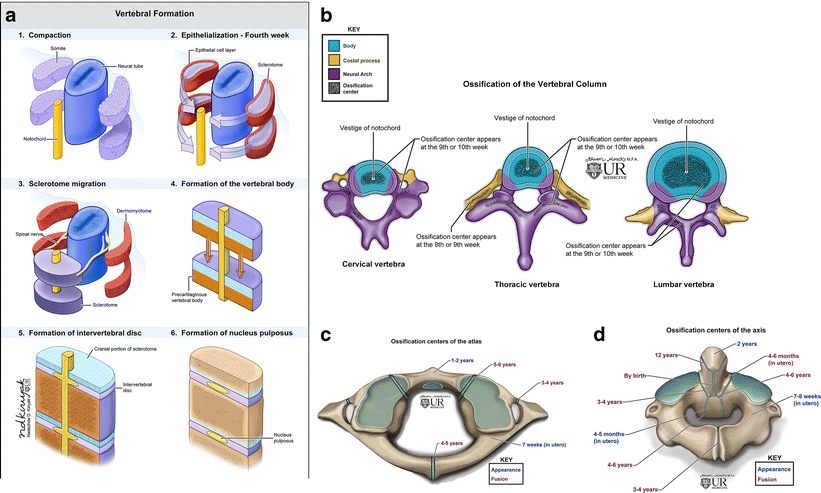 Malformed vertebrae: a clinical and imaging review | SpringerLink