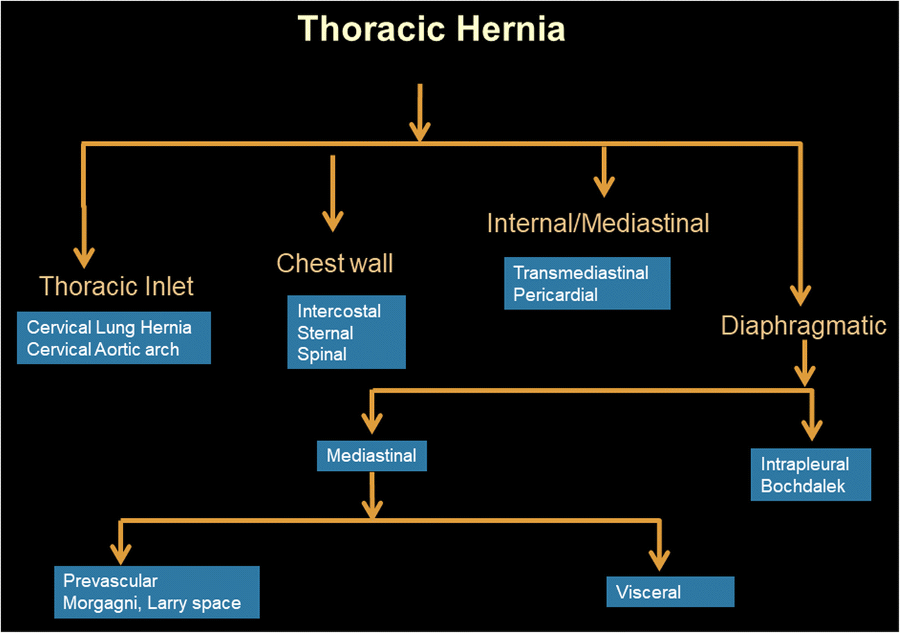 Imaging of thoracic hernias: types and complications | SpringerLink