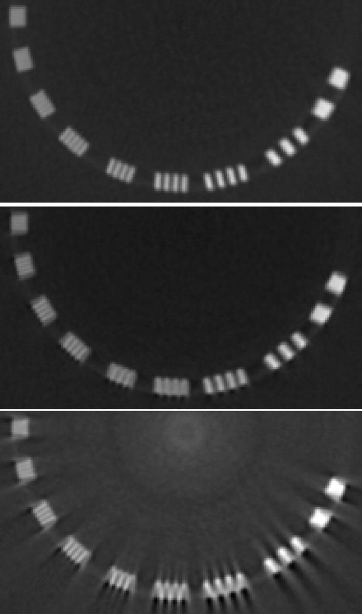 Image quality improvement for medium and large field of view Elekta XVI ...