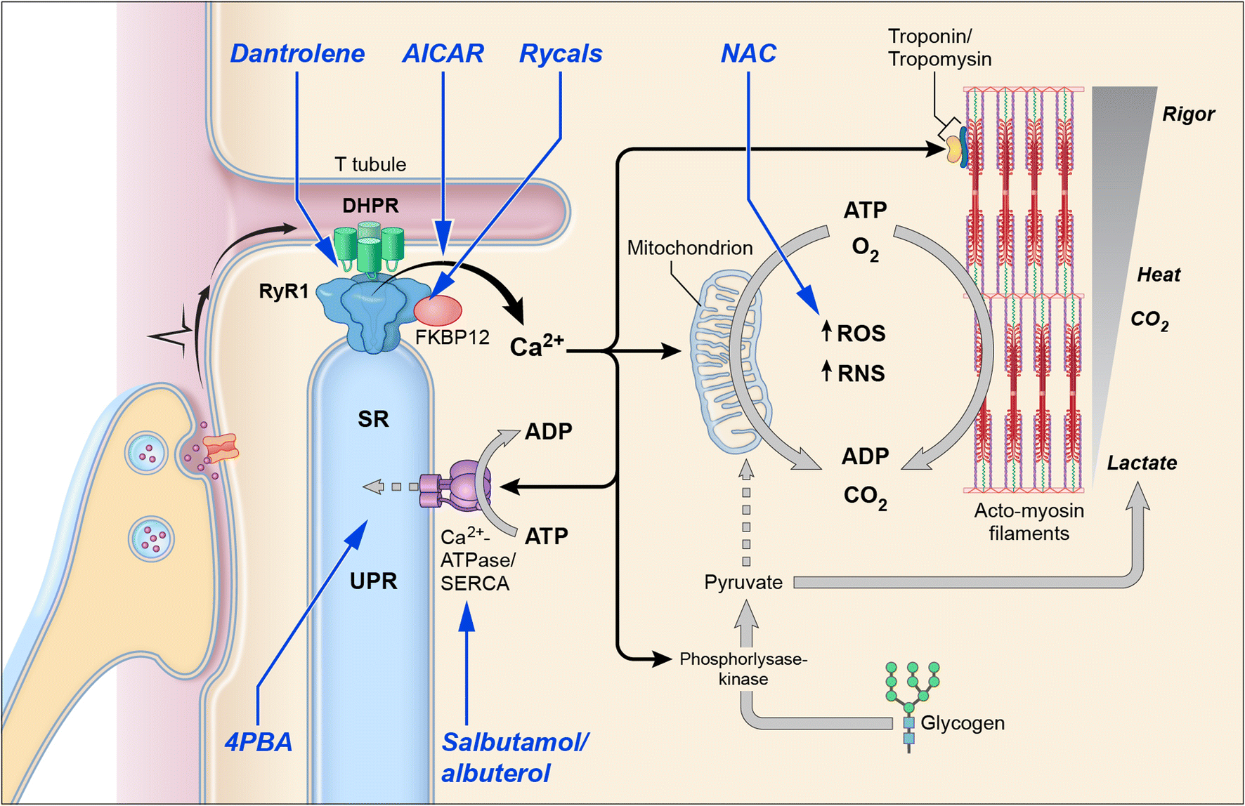 Ryanodine Receptor 1-Related Myopathies: Diagnostic and Therapeutic ...