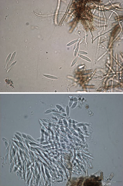 First report of Botryosphaeria dothidea causing shoot blight and ...