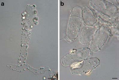 First report of the powdery mildew Erysiphe diffusa on soybean in ...