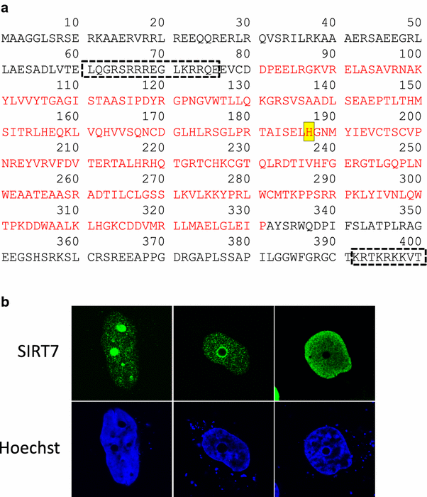 Role of SIRT7 in hepatic lipid metabolism | SpringerLink